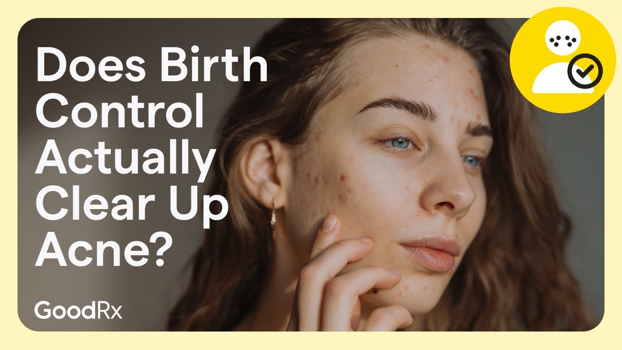 Does Birth Control Actually Clear Up Acne? An OB-GYN Explains | GoodRx