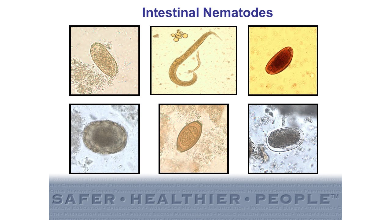 Diagnostic Features of Intestinal Nematodes