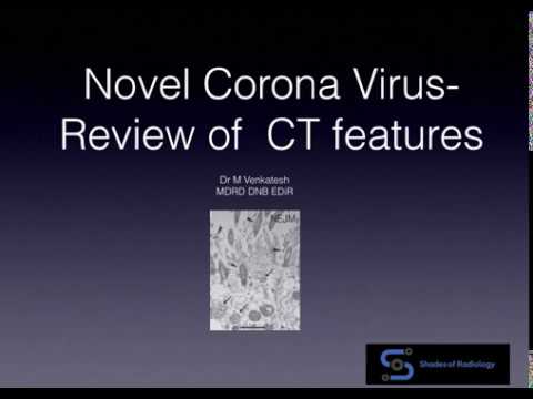n Corona virus 2019- COVID CT features