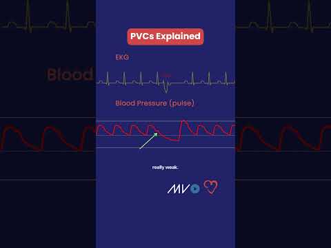 PVCs Explained ❤️⚡️