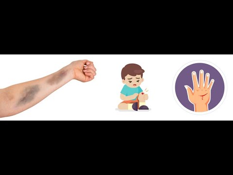 Learn how to say you are injured. Injuries