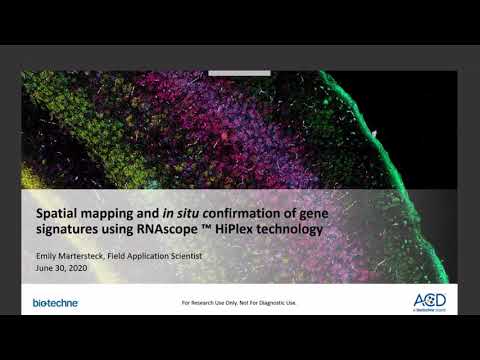 2020 June 30 - ACD Support Webinar - Hiplex