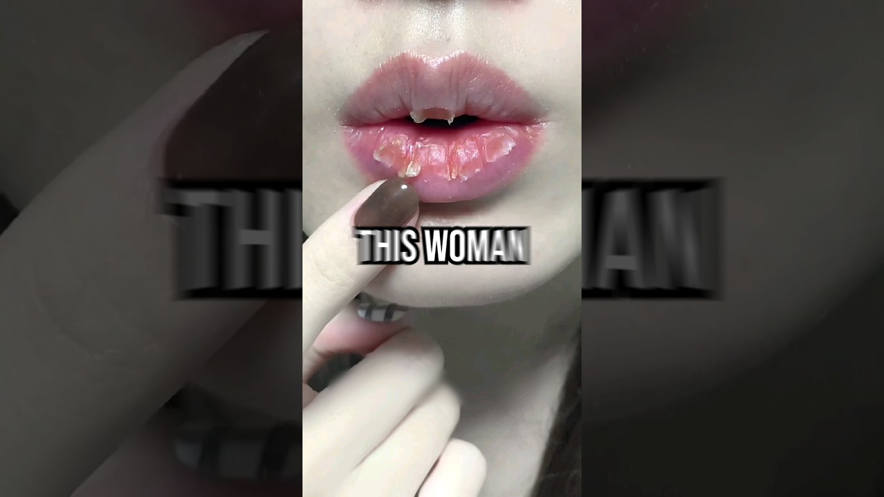 Lip Exfoliation is So Satisfying☺️