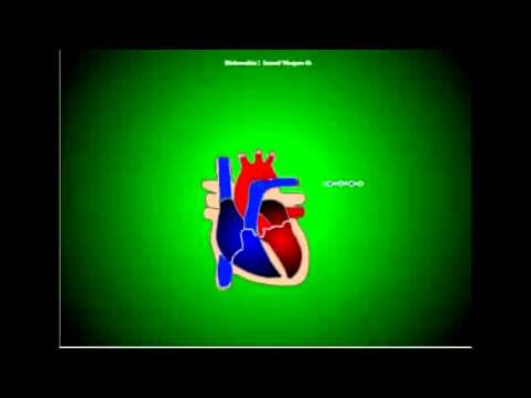 Sonidos del corazon ritmo cardiaco – urgencias medicas Batista-Hamad