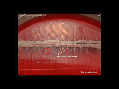Satellitism test