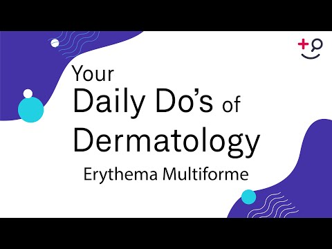 Erythema Multiforme - Daily Do's of Dermatology