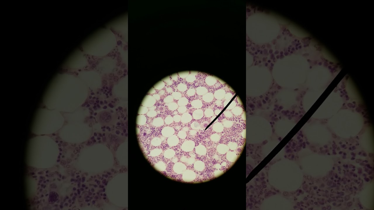 Red bone marrow megakaryocyte histology