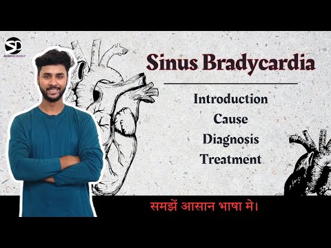 Sinus Bradycardia - Cause, Symptoms, Treatment | Low Heart Rate | Sedative Doctor #bradycardia