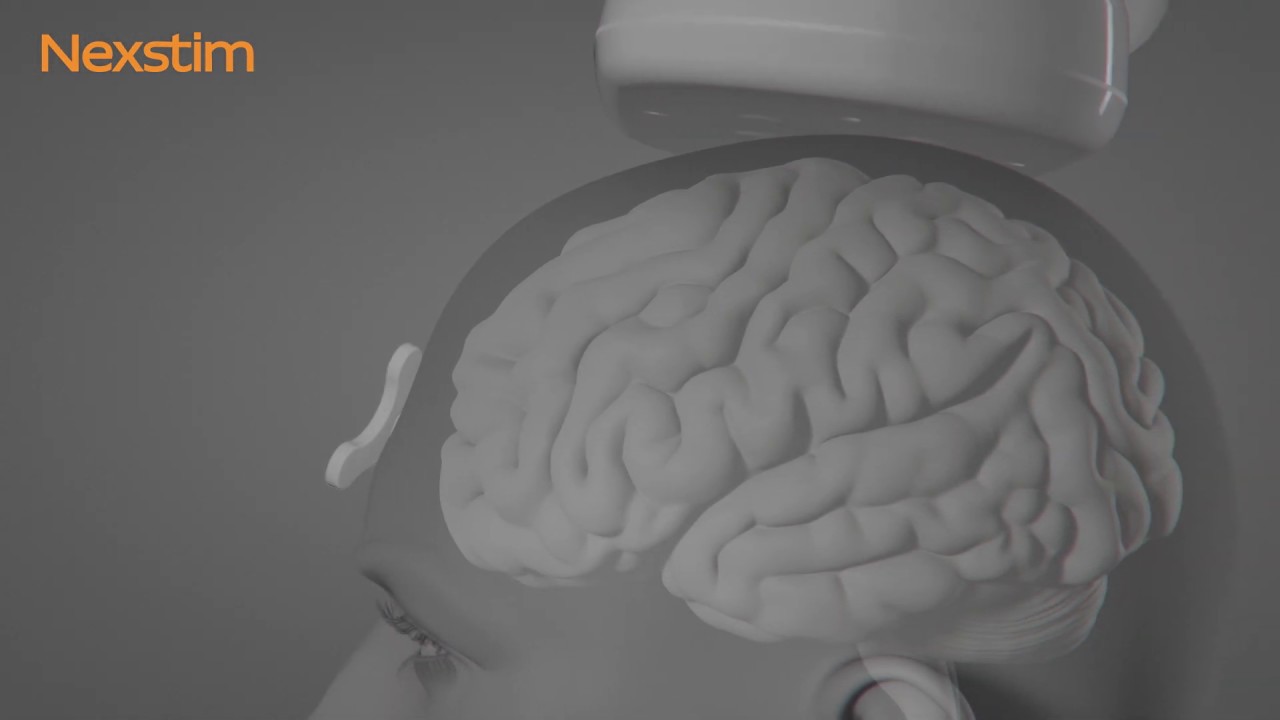 Nexstim SmartFocus® TMS with E-field Navigation