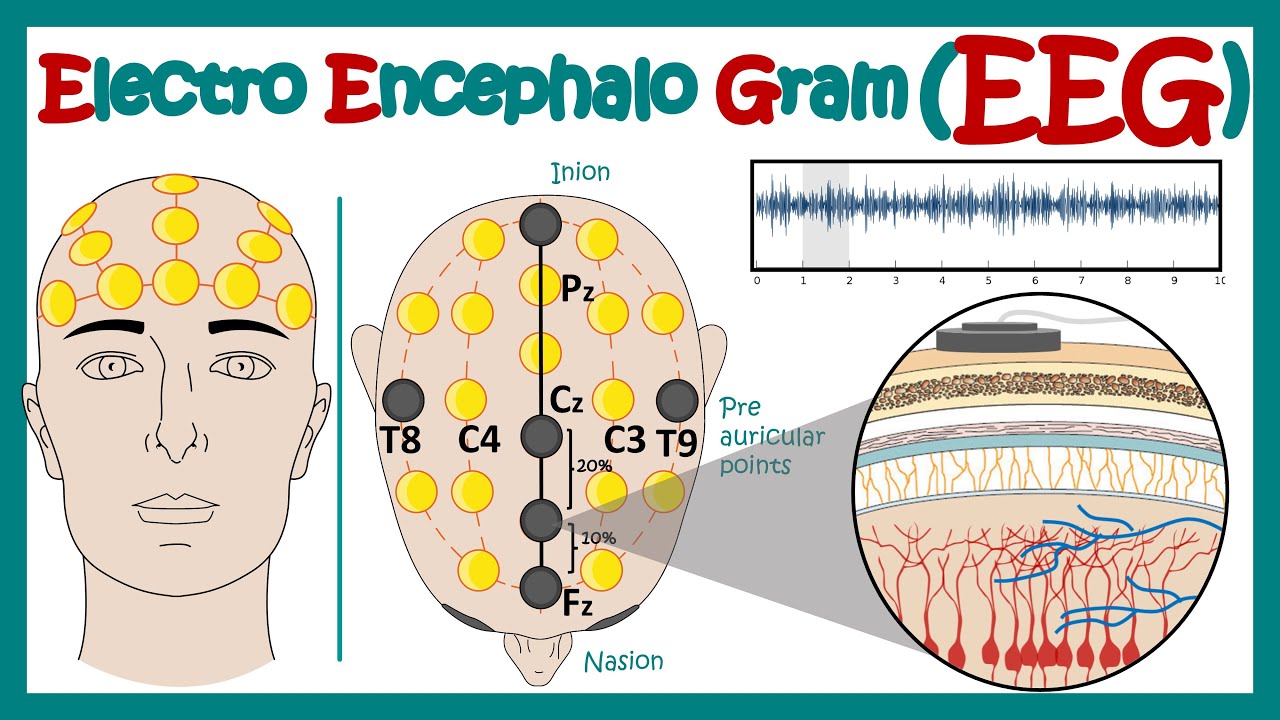 Understanding Electroencephalography (EEG): How It Works and Its ...