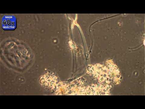 A Nematode and Shed Skin