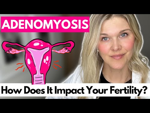 Adenomyosis: What are the Symptoms, Treatment, and Diagnosis? How Does It Impact Your Fertility?