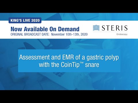King’s Live 2020 | EMR Procedure with COINTIP™ Snare