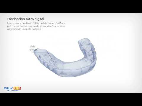 Bruxzero 3D Technology by Vesalius Dental & Medical