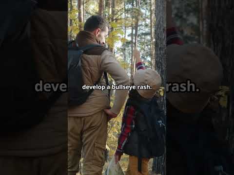 Let’s talk deer tick bites! #bullseyerash #symptomrecognition #erythemamigrans #lymedisease