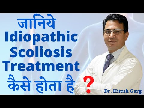 Idiopathic Scoliosis Treatment | Explained in Hindi