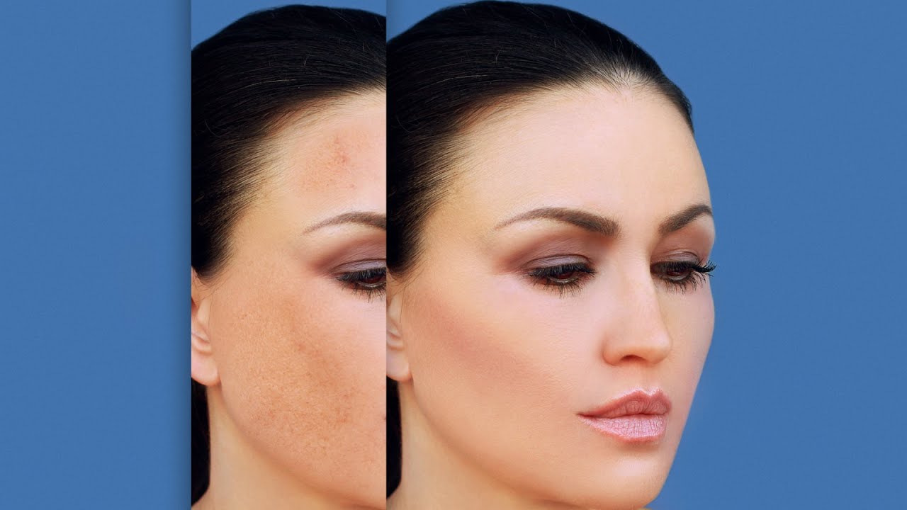 3 Simple Ways to Help Reverse Sun Damaged Skin