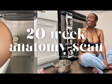 20 Week Anatomy Scan Vlog | GRWM + Morning Chit Chat