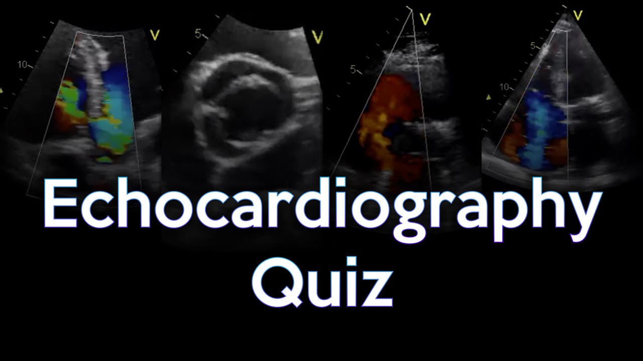 Echocardiography Quiz