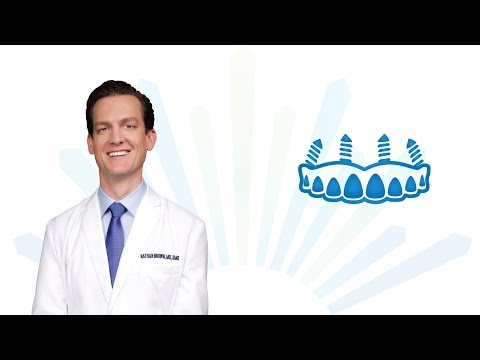All-on-4 Treatment Concept at Northlake Oral & Facial Surgery, Mandeville & Slidell LA