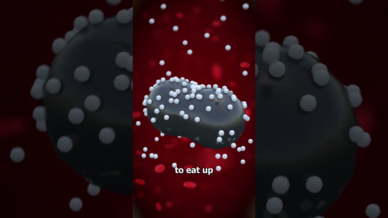 How Tattoos Are Removed 🤨