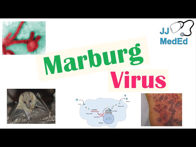 What are symptoms of the Marburg virus? Details explored as Ghana ...