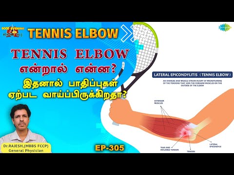 Tennis elbow என்றால் என்ன? | EP 305 | GOOD EVENING DOCTOR