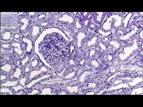 Simple Squamous Kidney.mp4