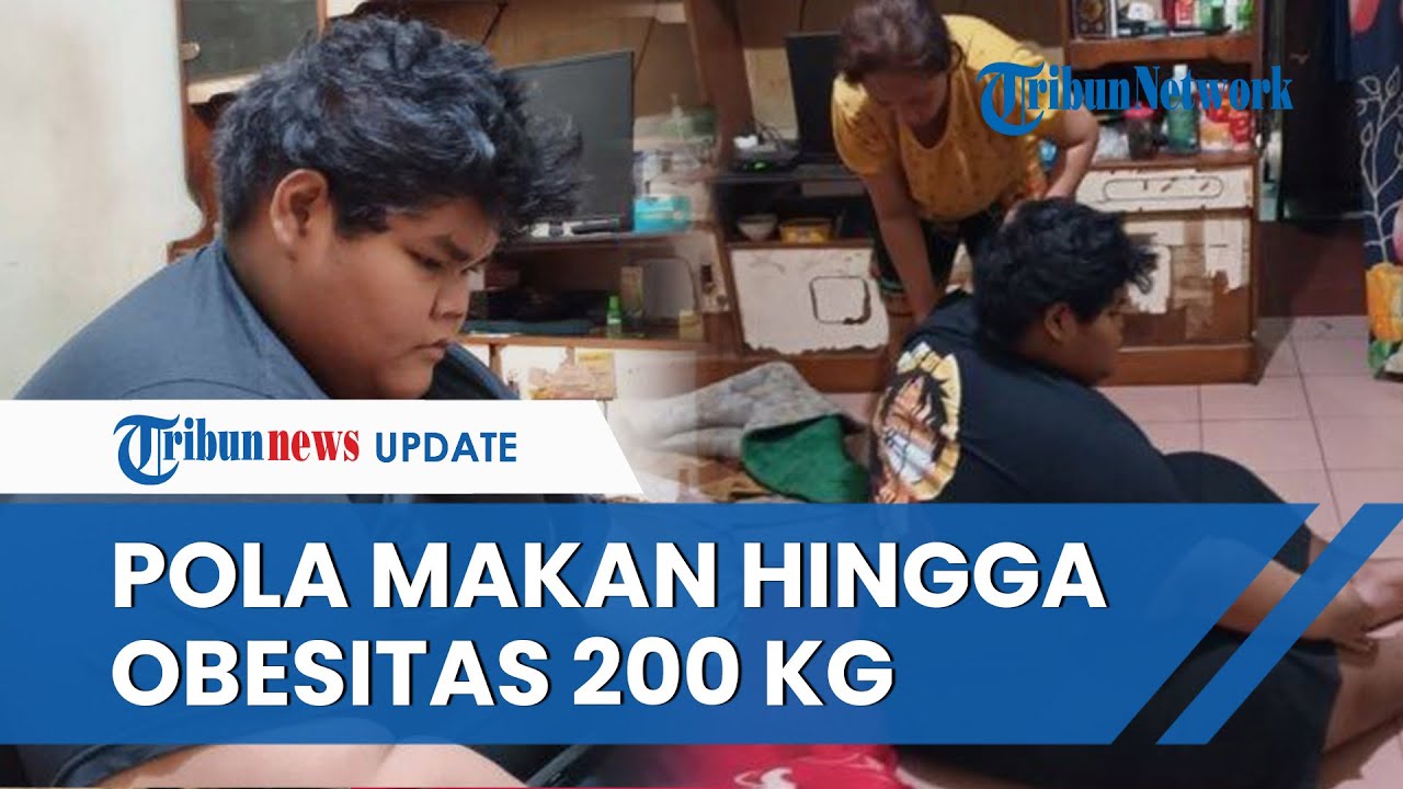 Obesitas sejak Umur 10 Tahun, Berat Badan Juwanto Remaja 200 Kg Naik ...