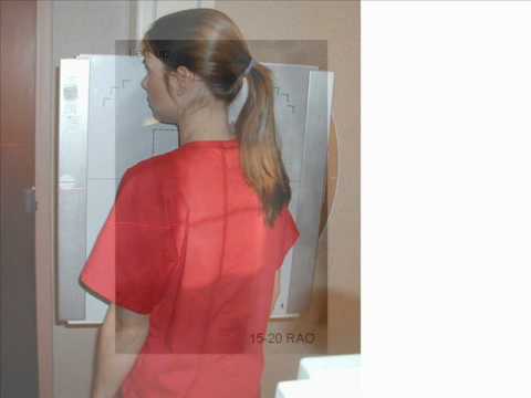 Sternum RAO « Medical Radiology - Canada, Winnipeg