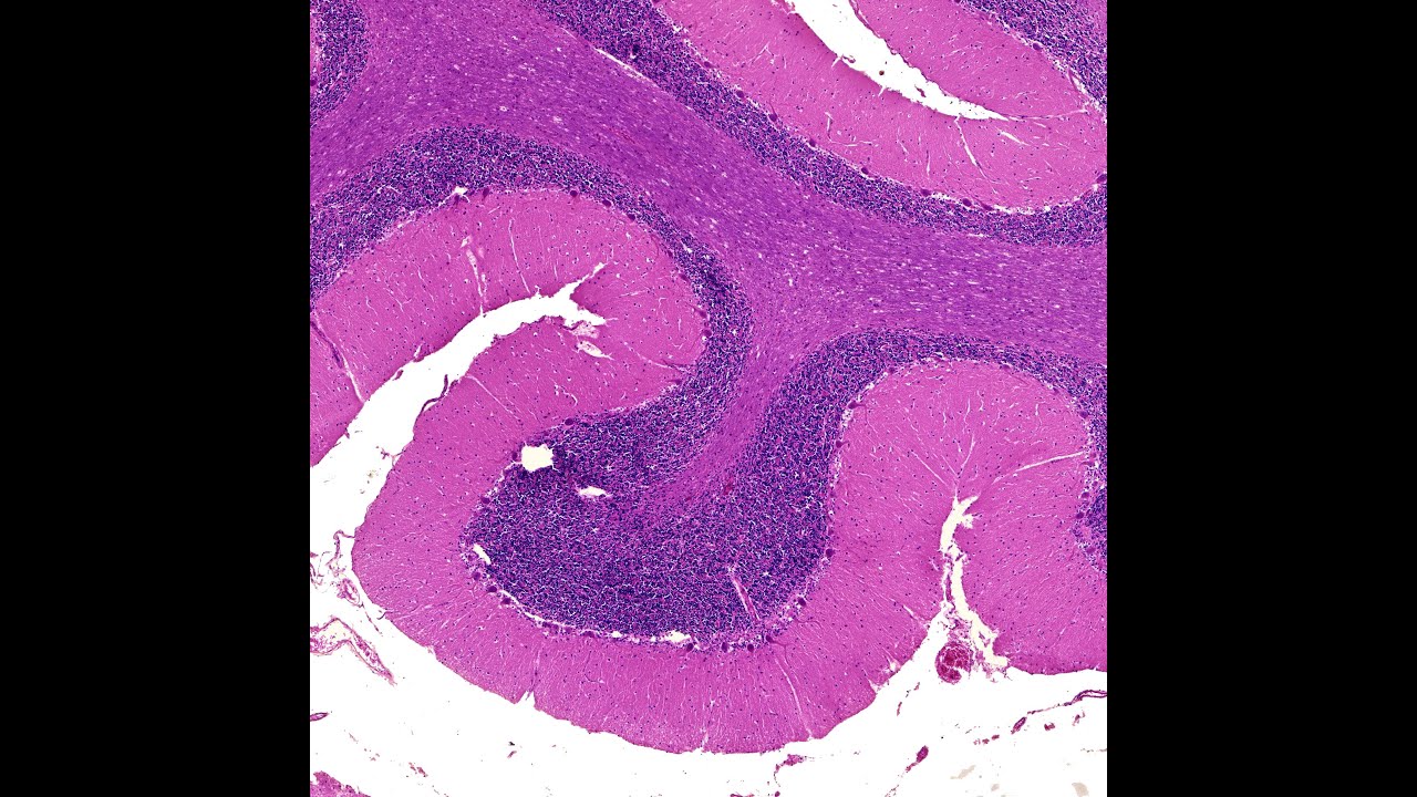 HISTOLOGY OF THE NEURON, SPINAL CORD, CEREBRUM and CEREBELLUM