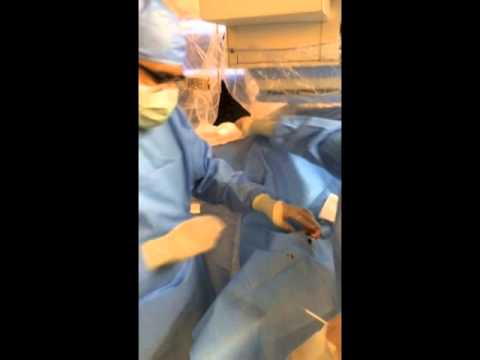 Accessing The Radial Artery