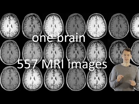 one brain - 557 MRI images