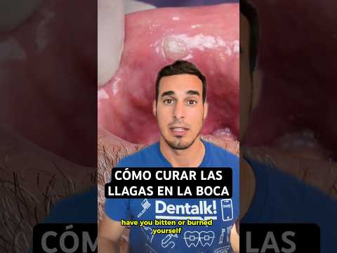 Cómo CURAR las LLAGAS, AFTAS o ÚLCERAS en la boca - Quemaduras y mordeduras en el labio y lengua