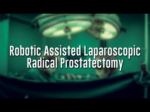Robot assisted laparoscopic prostatectomy - David E. Burday, MD