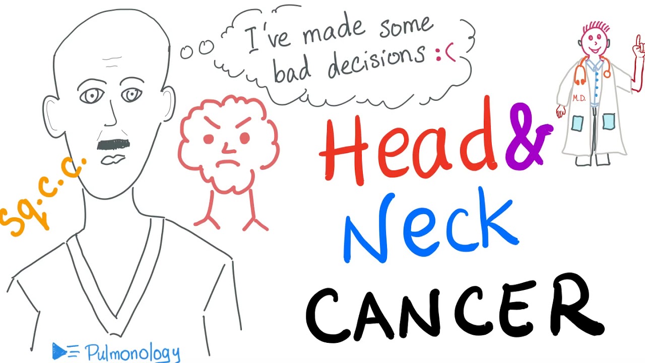 Head and Neck Cancer - Risk Factors, Pathology, Clinical Picture, Diagnosis and Management - Onco