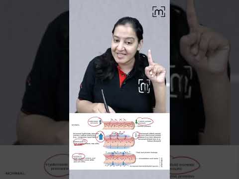 1 minute learning: Types of Oedema - Transudate and Exudate | MedLive | Dr. Priyanka Sachdev