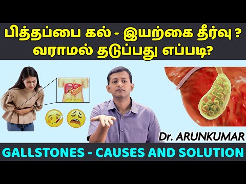 Gallstones – causes and dietary solution | பித்தப்பை கல் – காரணமும் தீர்வும் | Dr. Arunkumar