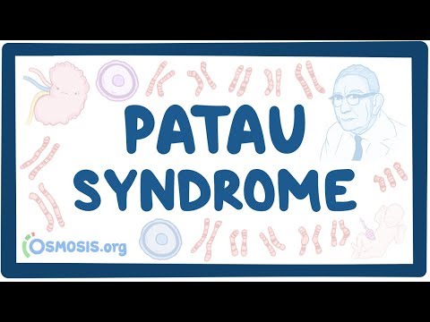 Patau Syndrome – causes, symptoms, diagnosis, treatment, pathology ...