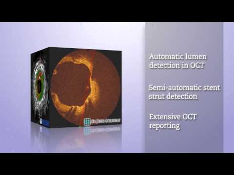 QIvus RE promotional movie 2015