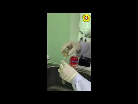 Proteinuria Asam Asetat