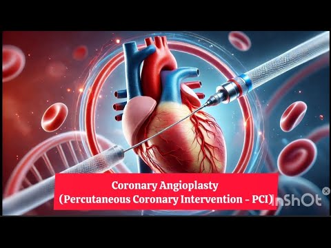 Coronary Angioplasty (Percutaneous Coronary Intervention - PCI)