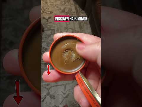 PRID Drawing Salve Hylands Naturals Drawing Salve Topical Irritations Relief Natural