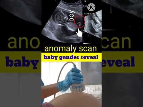 anomaly scan ultrasound। Gender Reveal #shortsvideo #ytshorts #pregnant #ultrasound #genderreveal
