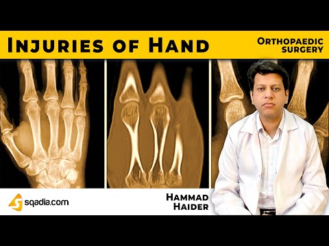 Injuries of Hand | Introduction
