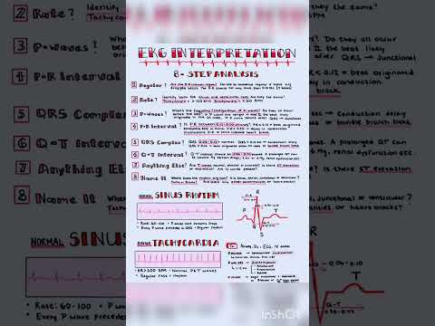 ECG interpretation in 8 simple steps #nursing #bsn #ECG#EKG