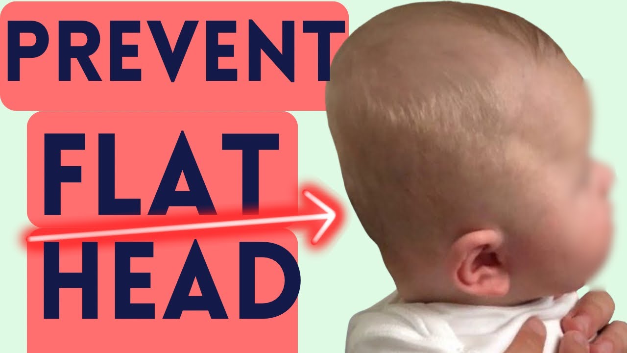 5 tips to PREVENT a baby flat head (plagiocephaly)
