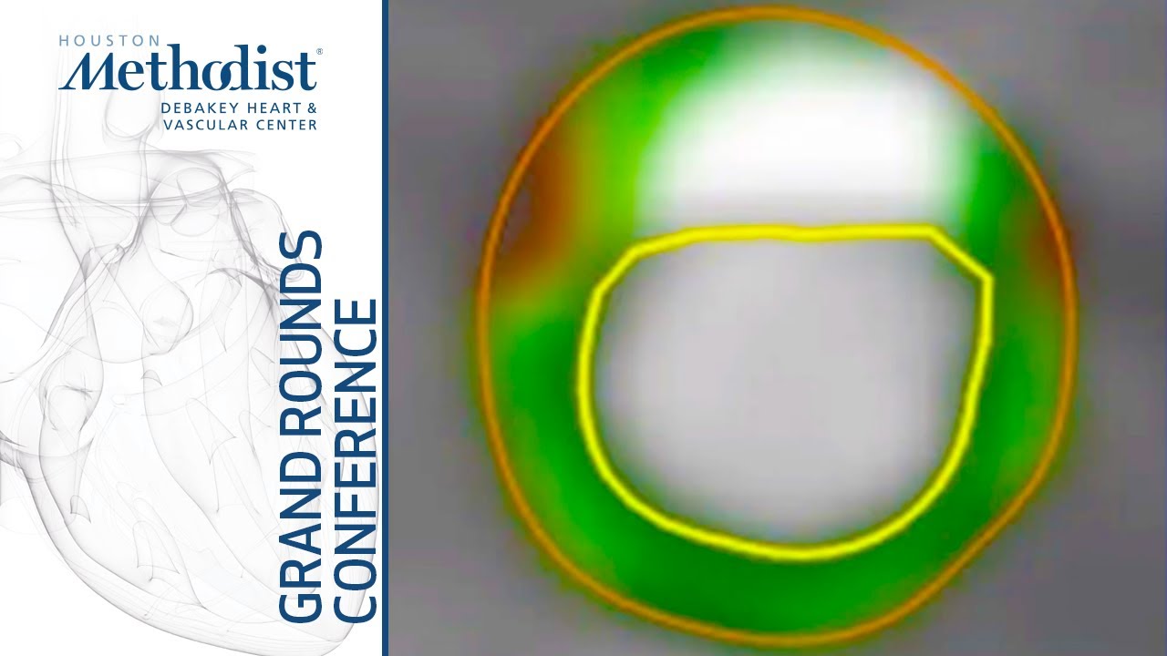 The Future of Imaging (Jeroen J. Bax, MD, PhD) March 10, 2022