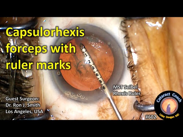 Surgical Instrument - Foreign Body Spud And Needle. Trader - Wholesaler ...