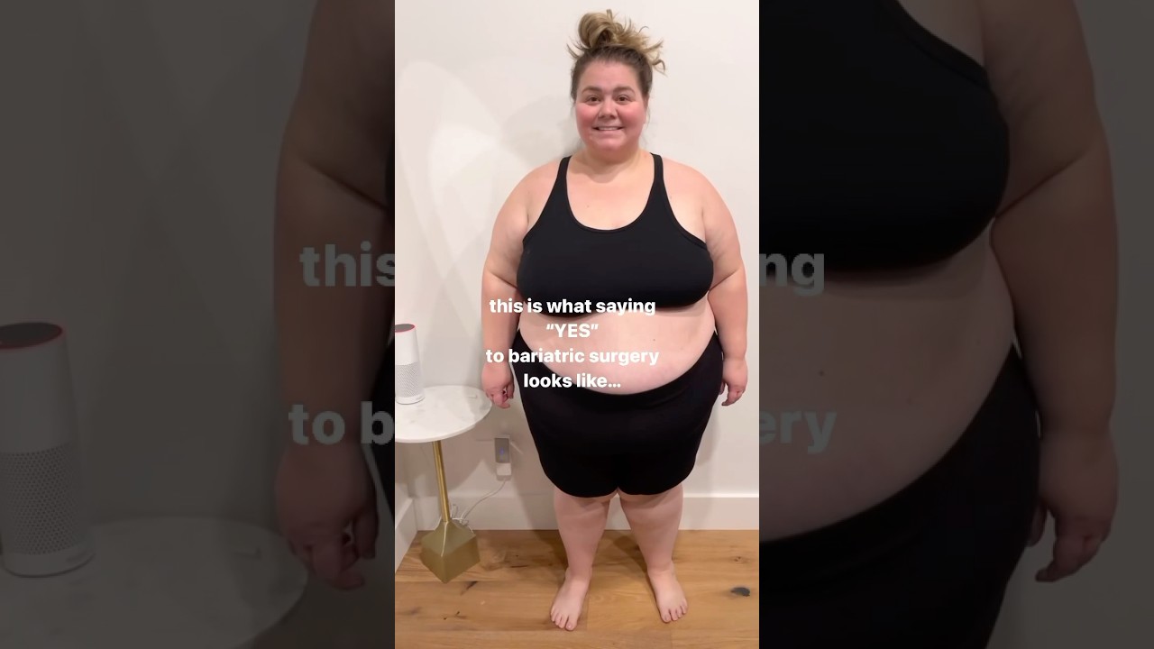 My before & after is dramatic.It's amazing what losing 270lb does #weightlosstransformation #shorts